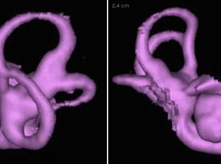 Institut für Bilddiagnostik | Felsenbeine
