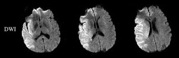 Institut für Bilddiagnostik | Gehirn